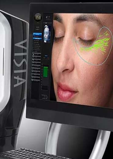 VISIA® Skin Analysis - Royal Centre of Plastic Surgery in Barrie